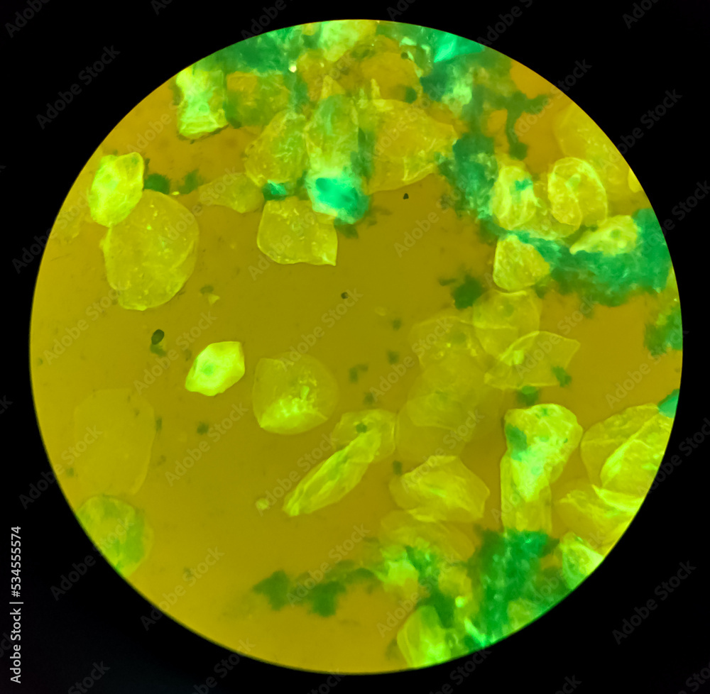 Zdjęcie Stock: Auramine O Stained slide microscopic 100x image human ... Zdjęcie Stock: Auramine O Stained slide microscopic 100x image human ...