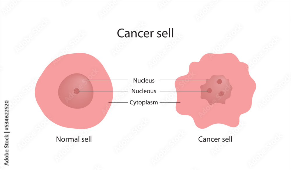 The structure of the cancer cell. Vector illustration. Stock Vector ...
