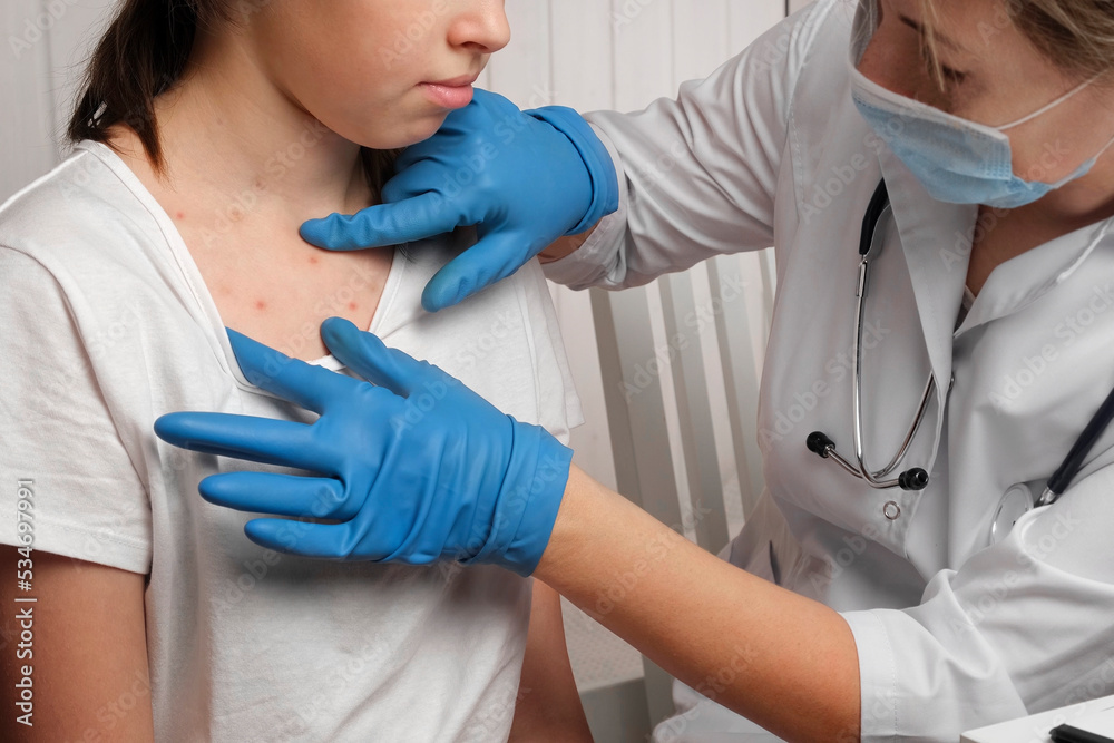 Doctor Checking Skin of Sick Girl. Kid with Red Rash being Examined at ...