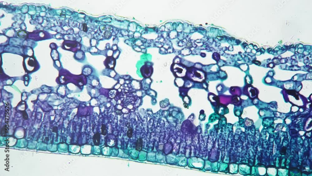 Microscope image of Leaf of Jasminum nudiflorum T.S. 200x against ...