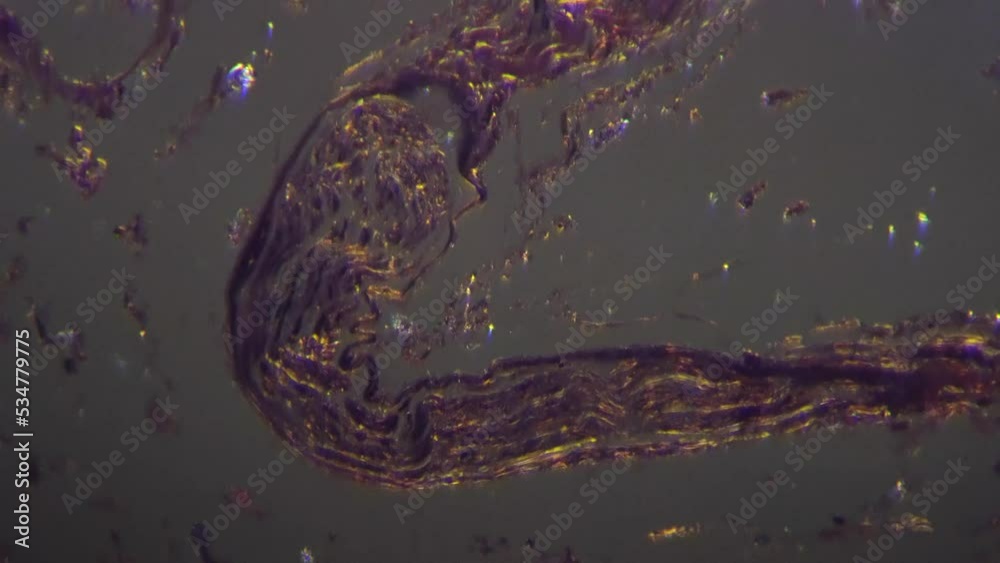 Sweat glands on human skin filmed under microscope 400x with oblique ...