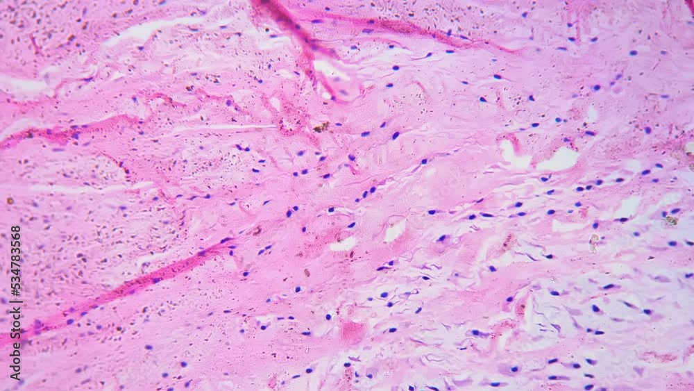 Dense connective tissue in longitudinal section filmed by microscope ...