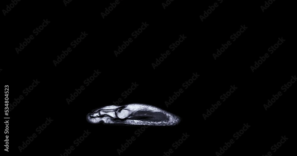 MRI foot scan for a diagnostic tool used to image the structures of the ...
