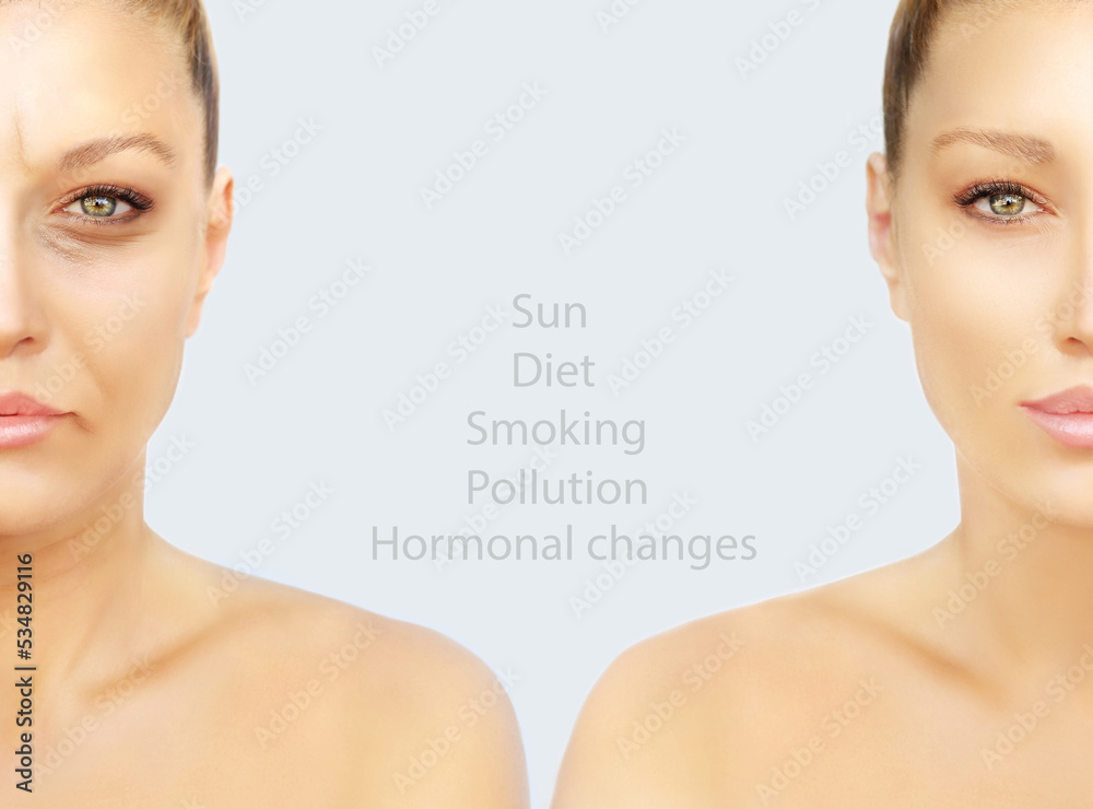 Ageing skin ,internal and external causes of skin aging, signs of skin ...