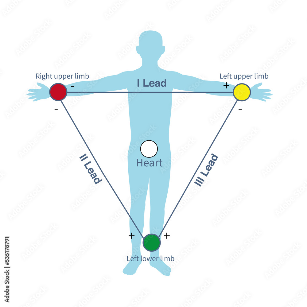 Fototapeta Einthoven triangle assumes that the left upper limb, right ...