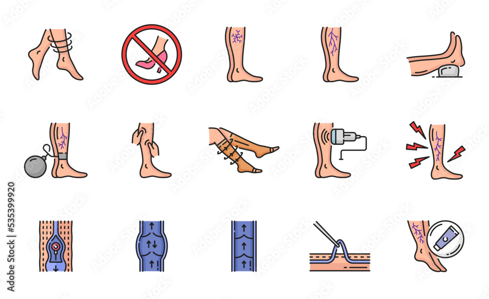 Varicose treatment icons, leg veins disease and thrombosis surgery ...
