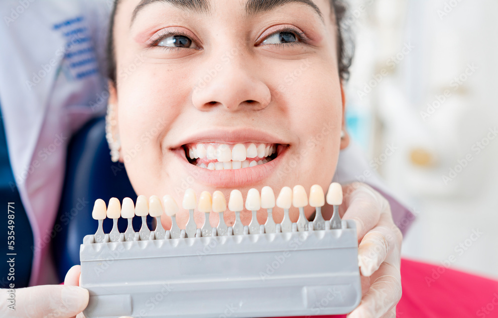 Dentist holding a set of implants with various shades of tone. Patient ...