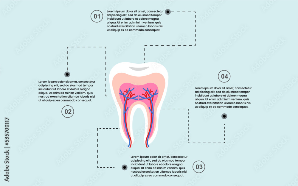 Anatomy and tooth structure, cavity. infographic template with four ...