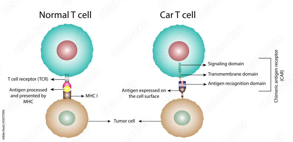 Normal T cell and Chimeric antigen receptor T cell ,CAR T cell, for use ...