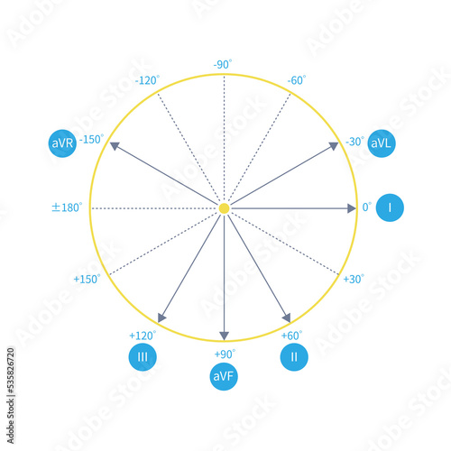 Plakat In the frontal lead system, the lead axes of the 6 limb leads ...