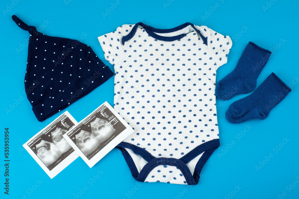 ultrasound (USG) results in sheets and baby clothes on blue background ...
