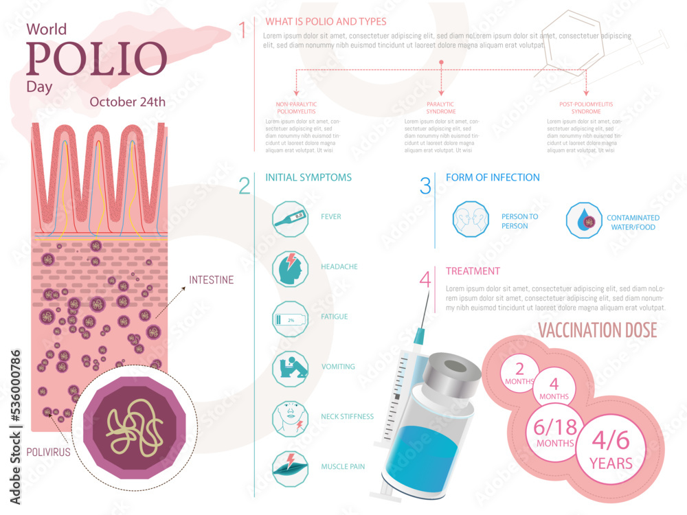 Infographic about polio disease, symptoms and treatment. Celebration of ...