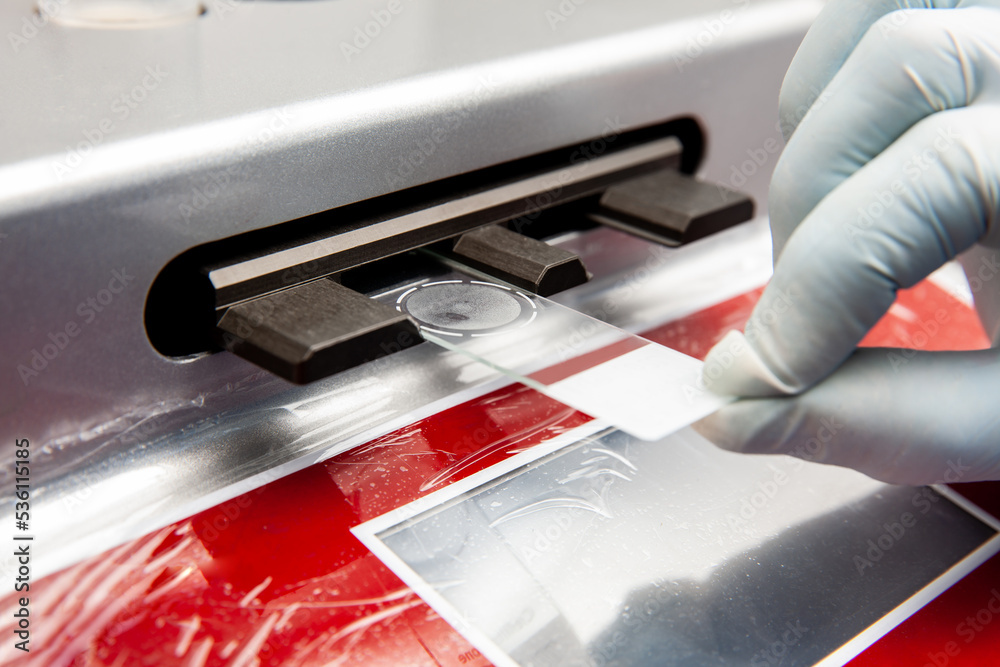 Scientist preparing microscope slides with liquid based cytology method ...