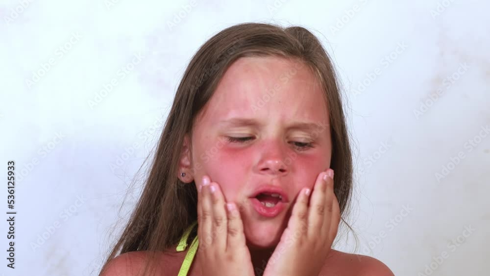 Portrait of sad little girl touching burnt reddened skin on face with ...