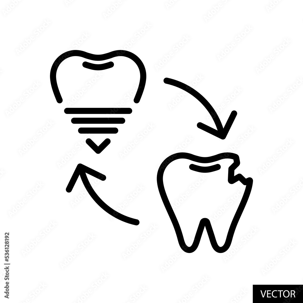 Broken, Cracked, damaged tooth replacement, Teeth implant, Dental ...
