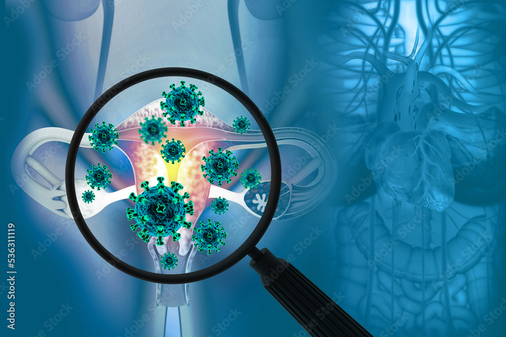 virus or bacteria infected female reproductive system, Uterine diseases ...