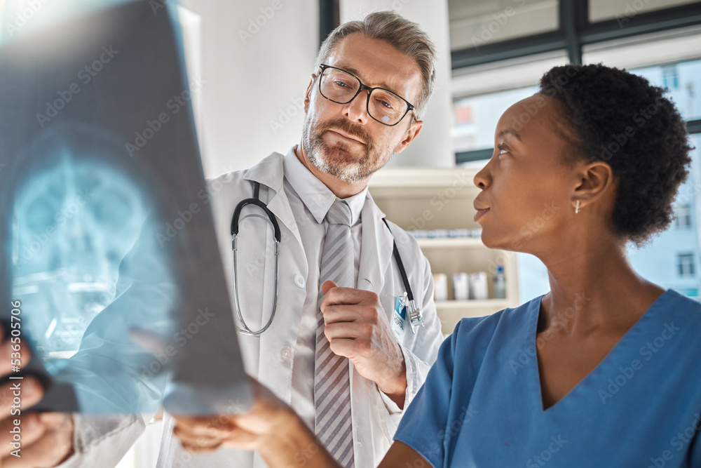 Brain, x ray and neurology doctors in a meeting working on a skull ...