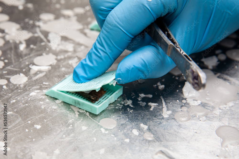 Cassette containing a biopsy sample. Scientist embedding tissues in ... Cassette containing a biopsy sample. Scientist embedding tissues in ...