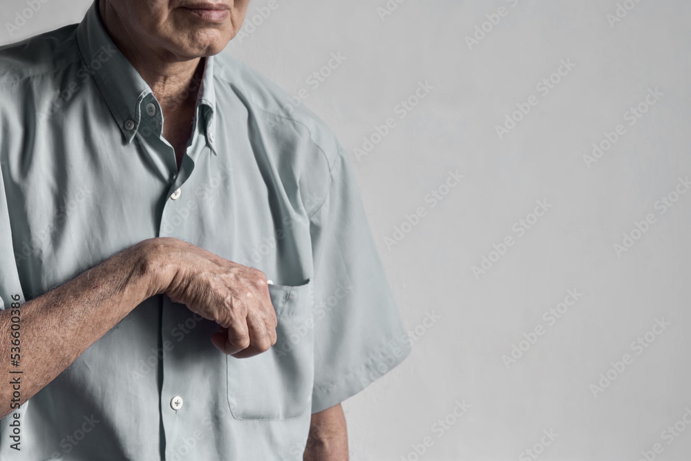 Hand muscle rigidity and finger flexion of Asian man. Stock Photo ...