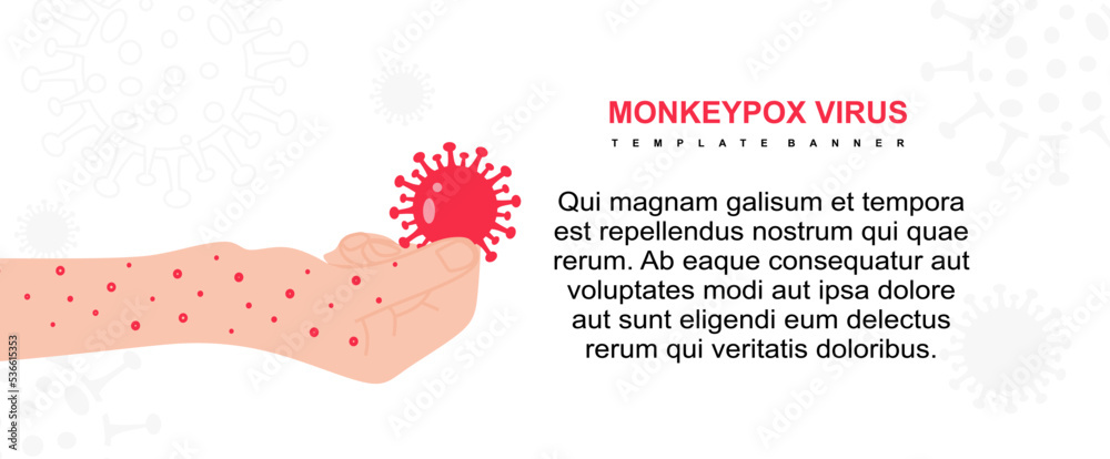 Monkeypox virus banner for awareness and alert against disease spread ...
