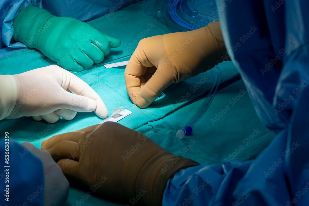 Step by step Visualase is an MRI-guided laser ablation system used to ...