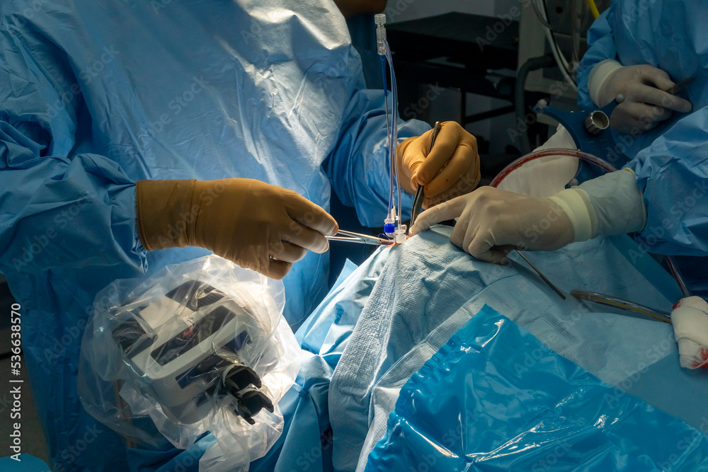 Step by step Visualase is an MRI-guided laser ablation system used to ...