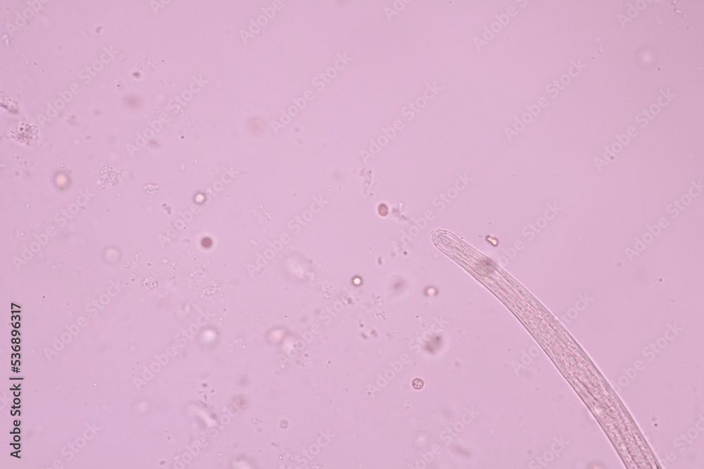 View in microscopic Strongyloides stercoralis or threadworm in human ...