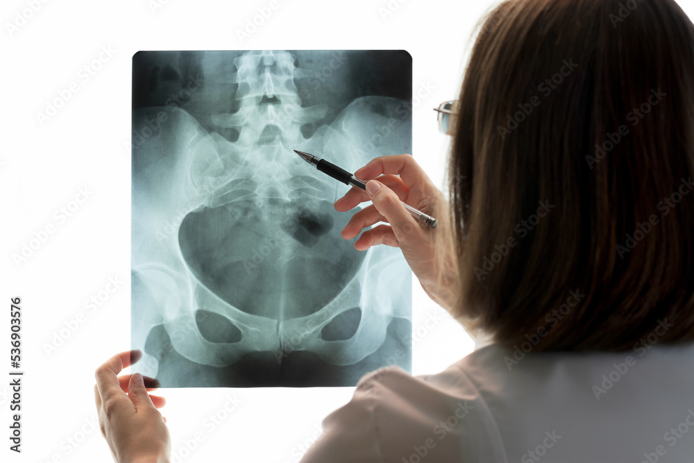 Female doctor holds and examines pelvic bones scan against background ...