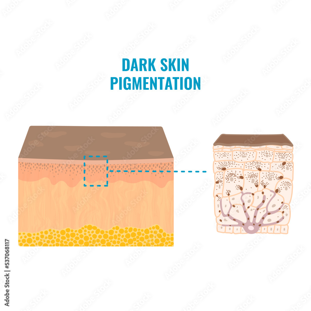 Melanin content and distribution in dark skin phototype. Pigmentation ...