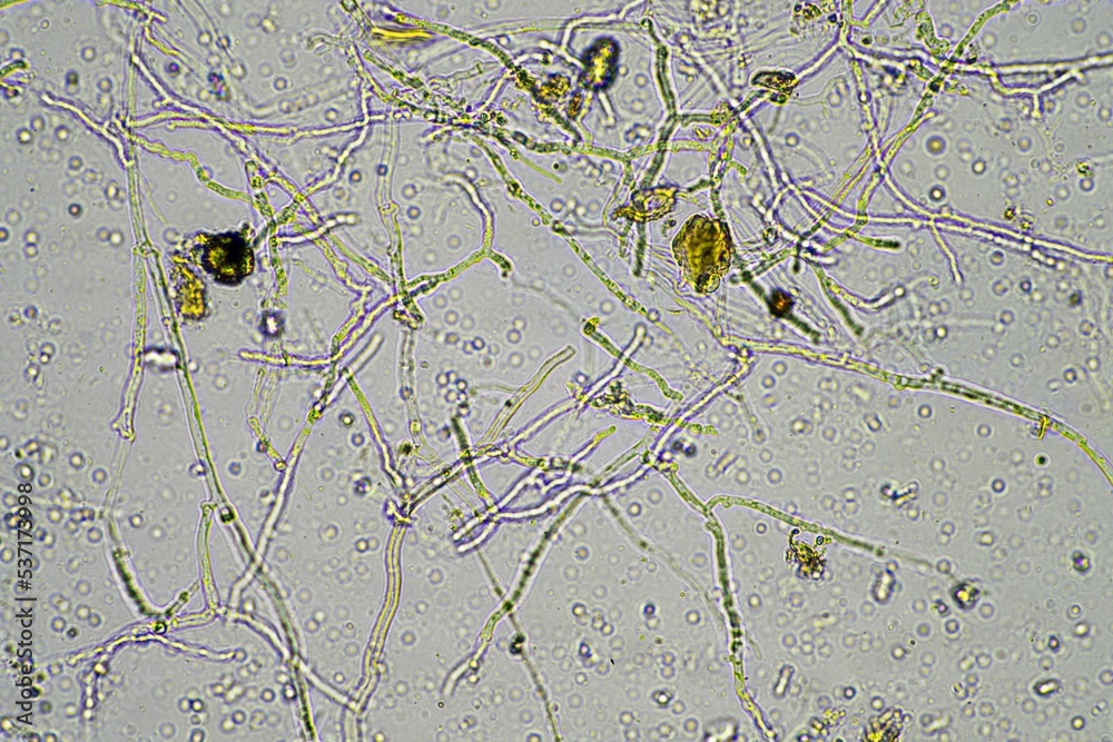 soil fungi under the microscope, soil microbes organisms in a soil and compost sample, fungus ...