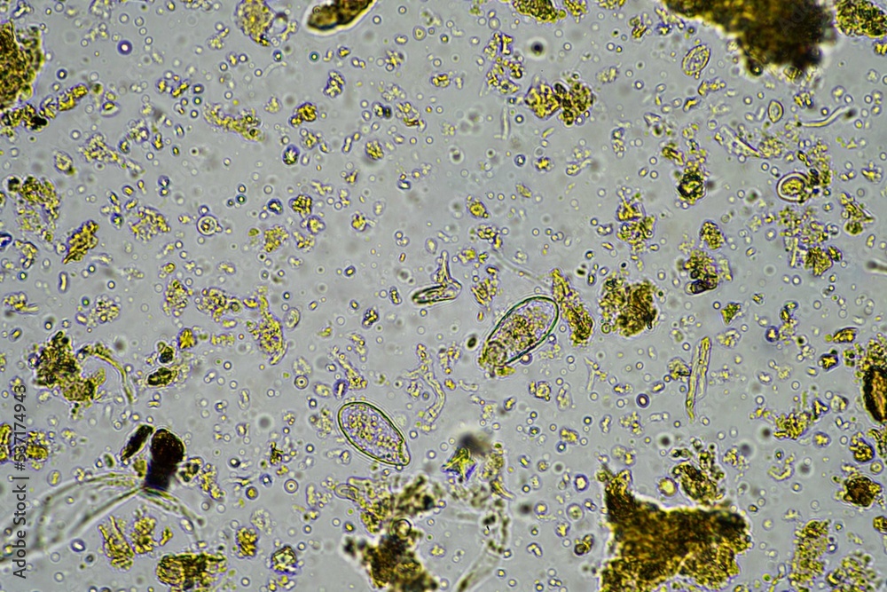 microorganisms and soil biology, with nematodes and fungi under the ...