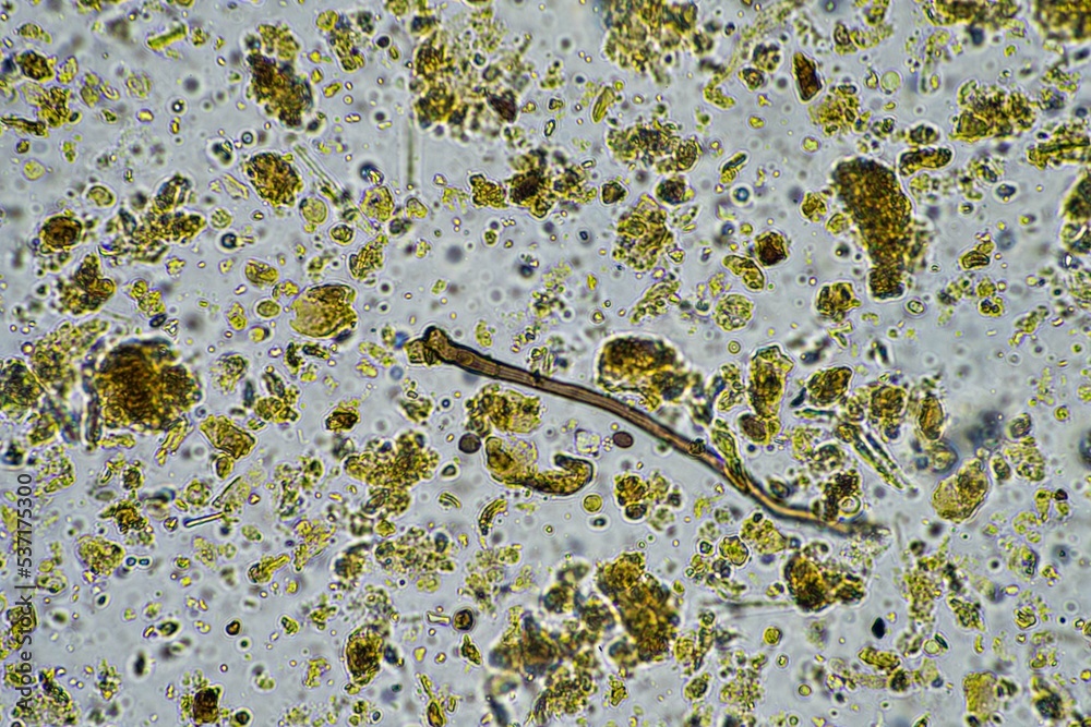 soil fungi under the microscope, soil microbes organisms in a soil and ...