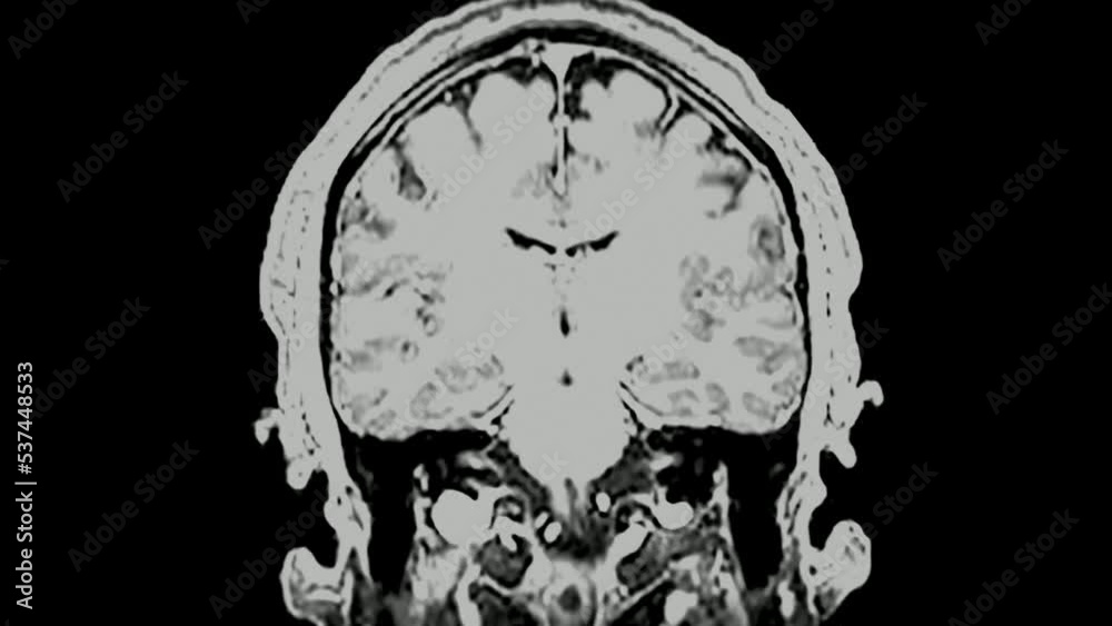 Magnetic resonance imaging MRI brain scan using magnetic field and ...