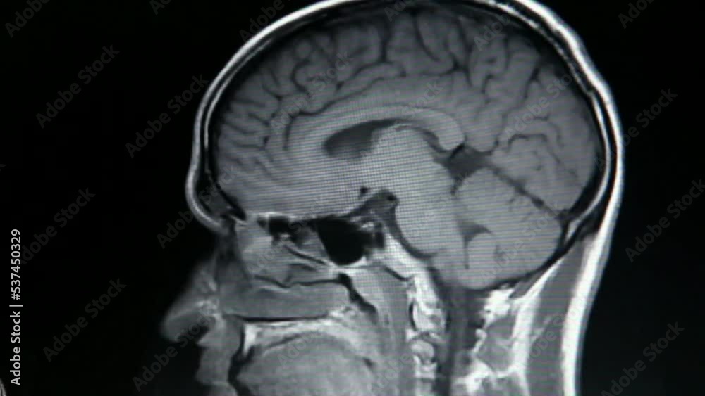 Magnetic resonance imaging MRI brain scan using magnetic field and ...