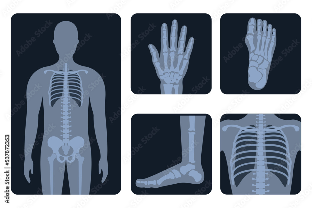 Various X-ray images of human body parts Stock Vector | Adobe Stock