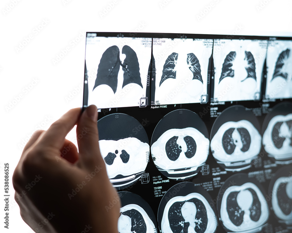 A female doctor examines an MRI scan of the internal organs. Abdomen ...
