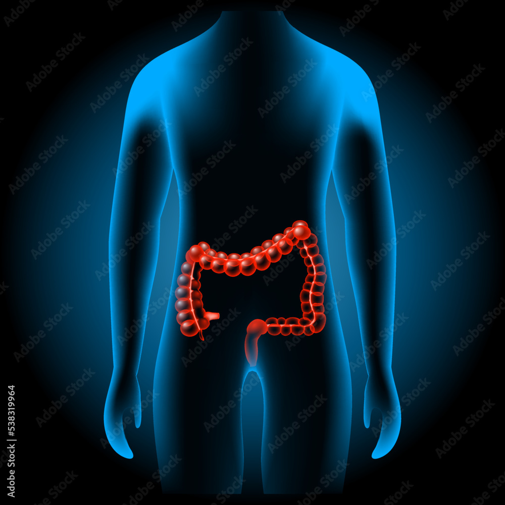 Large intestine into x-ray blue realistic torso. Stock Vector | Adobe Stock