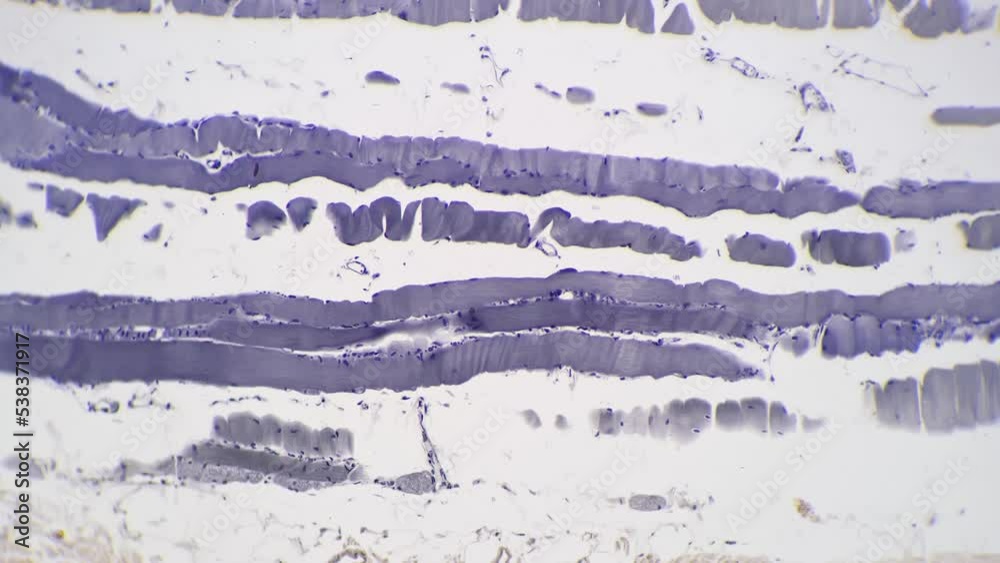 Skeletal muscle L.S. under microscope filmed with 100 times ...