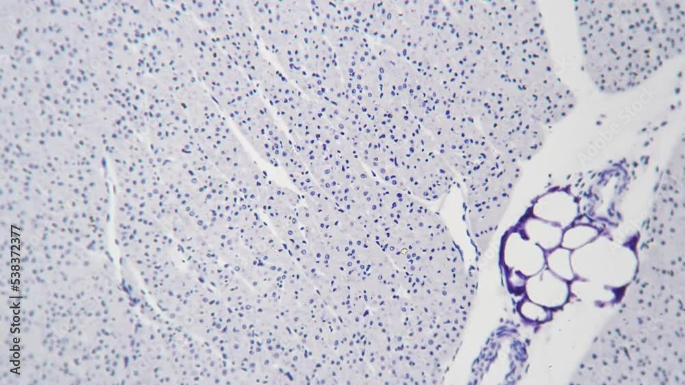 Cardiac muscle in section filmed on bright field background under ...