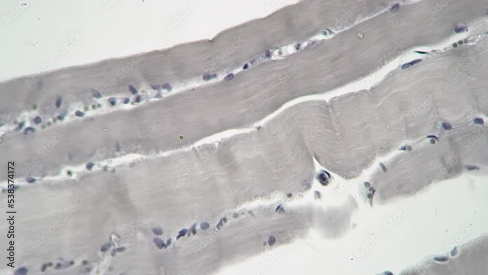 Skeletal muscle in longitudinal section under microscope filmed with ...
