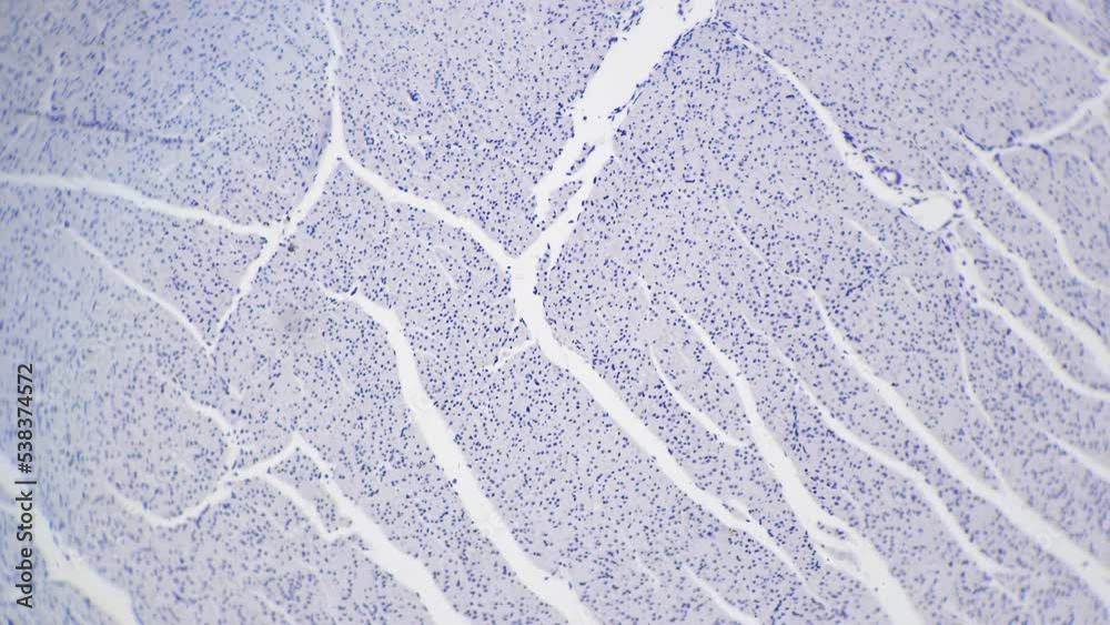 Cardiac muscle in section filmed on bright field background under ...