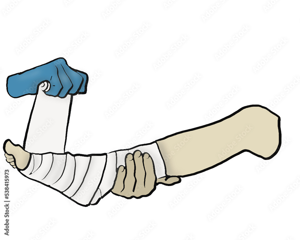 Wound care concept: Clipart of a dressage on a leg, nursing art in ...