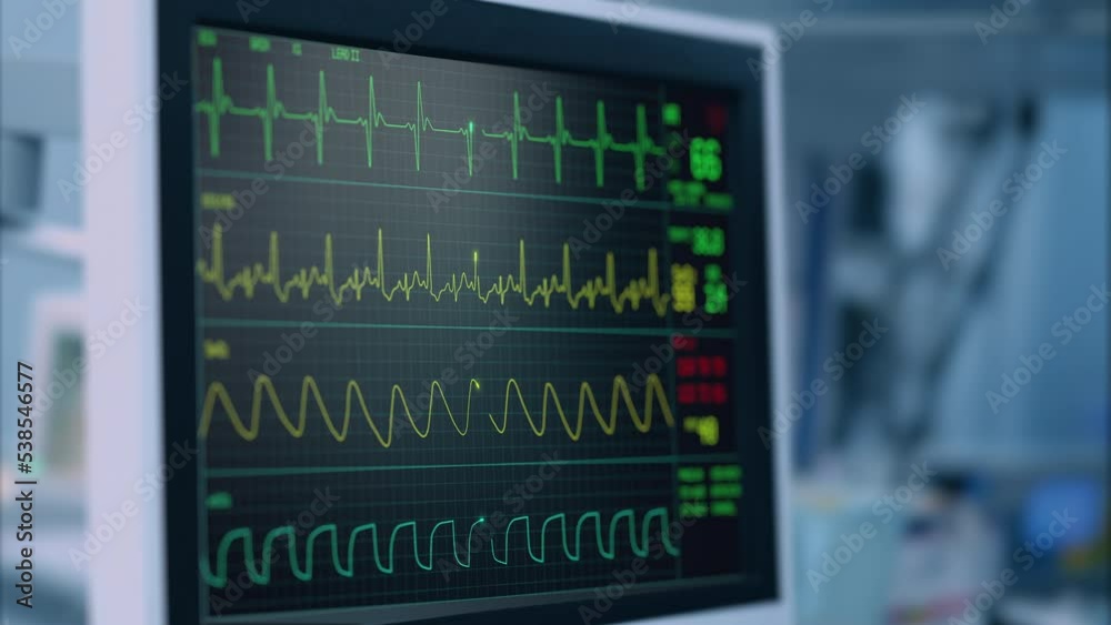 Vidéo Stock Patient monitor displays vital signs ECG electrocardiogram ... Vidéo Stock Patient monitor displays vital signs ECG electrocardiogram ...