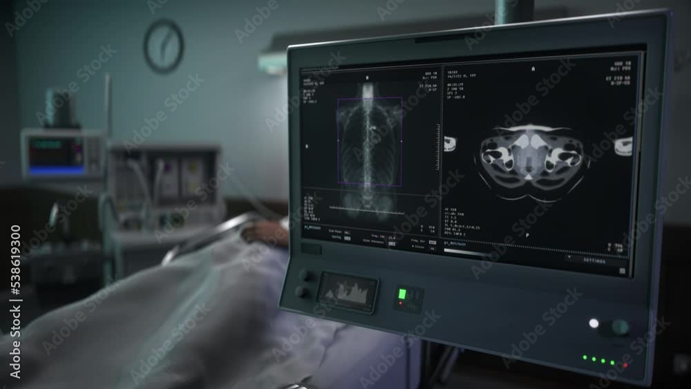 X-ray injury examination device analysing the suffering patient. X-ray ...