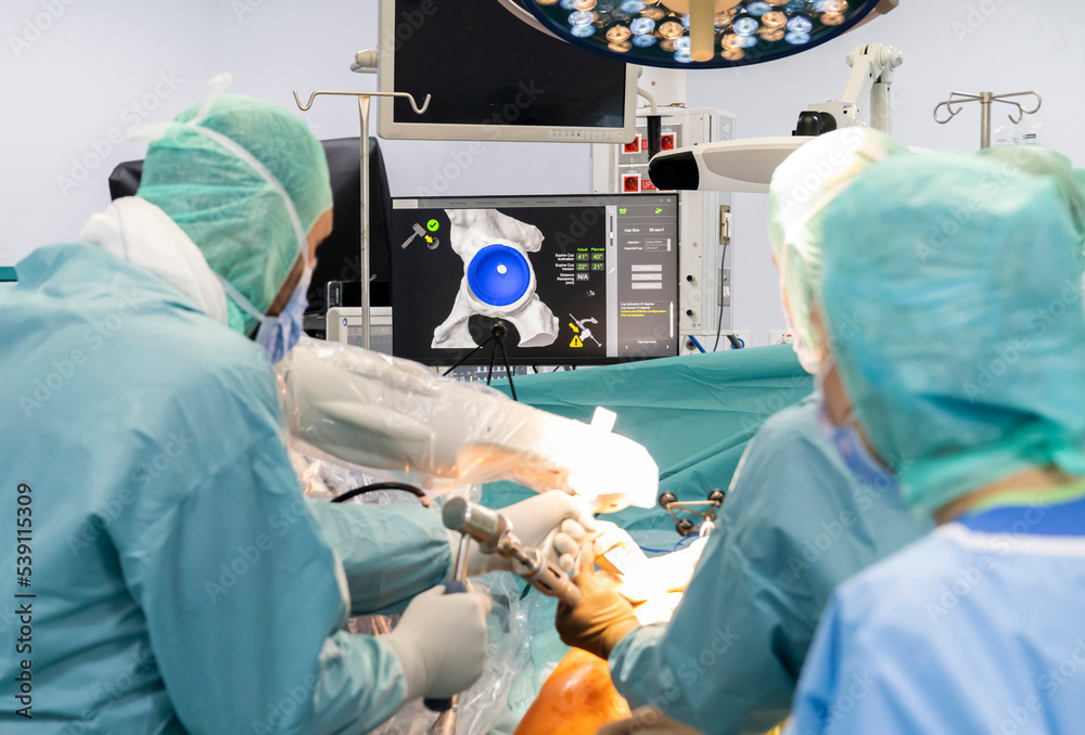 Team of doctor perform total hip arthroplasty replacement surgery in ...