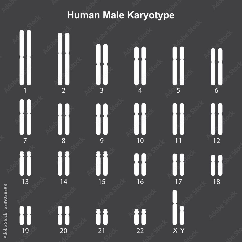 Scientific Designing of Male Normal Karyotype. Male Complete Set of ...