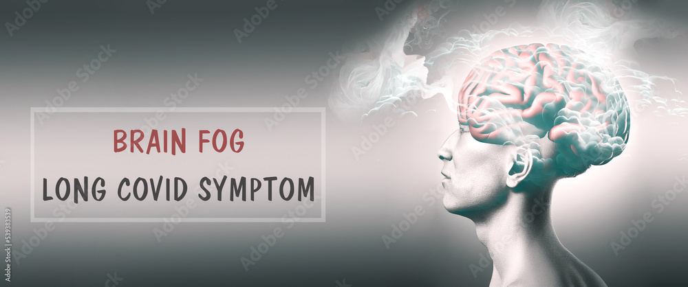 Brain fog, long covid symptom, illustration of a man with a brain ...