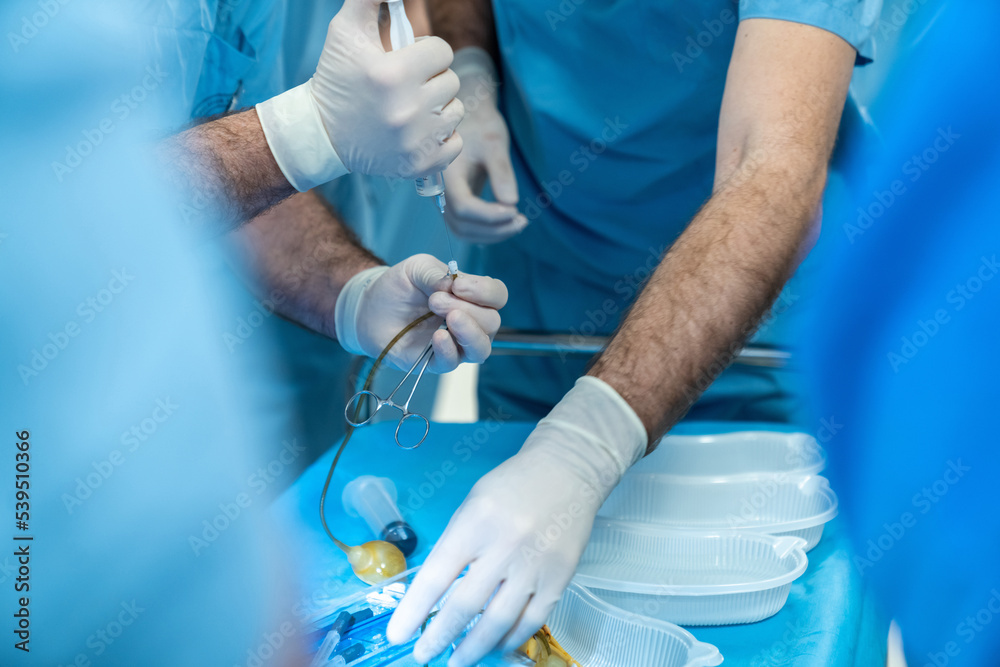 penis penile implant, penis enlargement surgery, balloon insertion ...