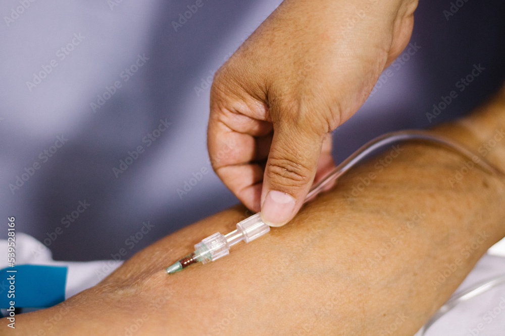 Mano colocando intravenosa para suero Stock Photo | Adobe Stock