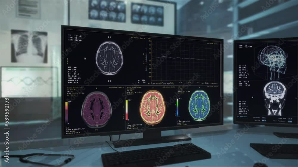 Monitoring device inspecting the organ injuries in the patients skull ...